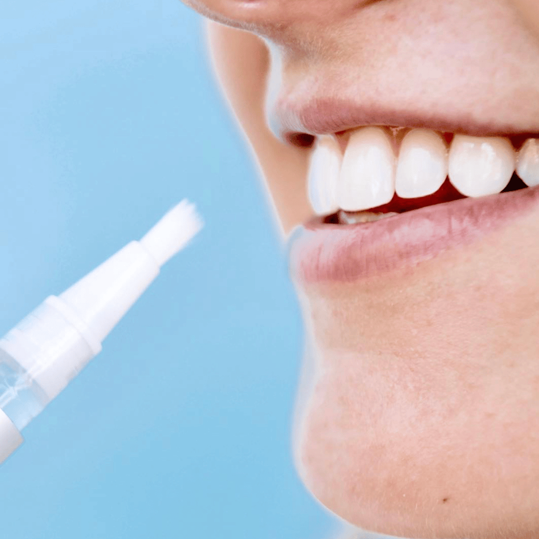 Teeth Whitening in Austin, TX | We Whiten