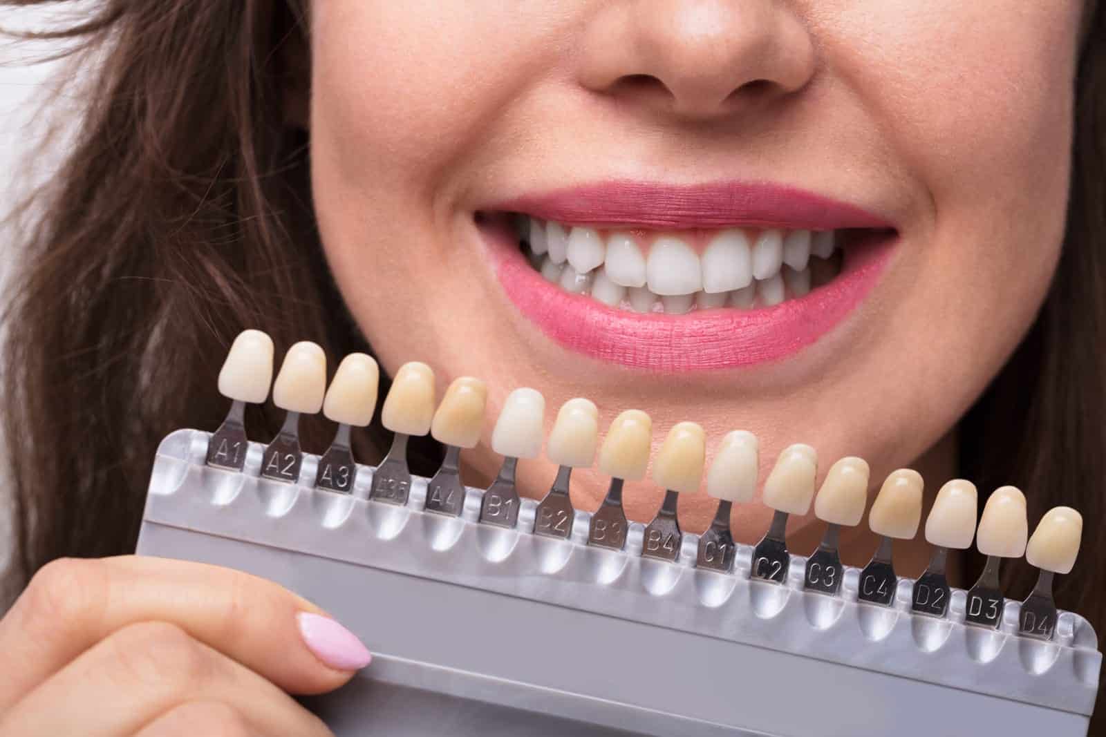 Shades of Teeth Guide: Understanding Your Smile | We Whiten